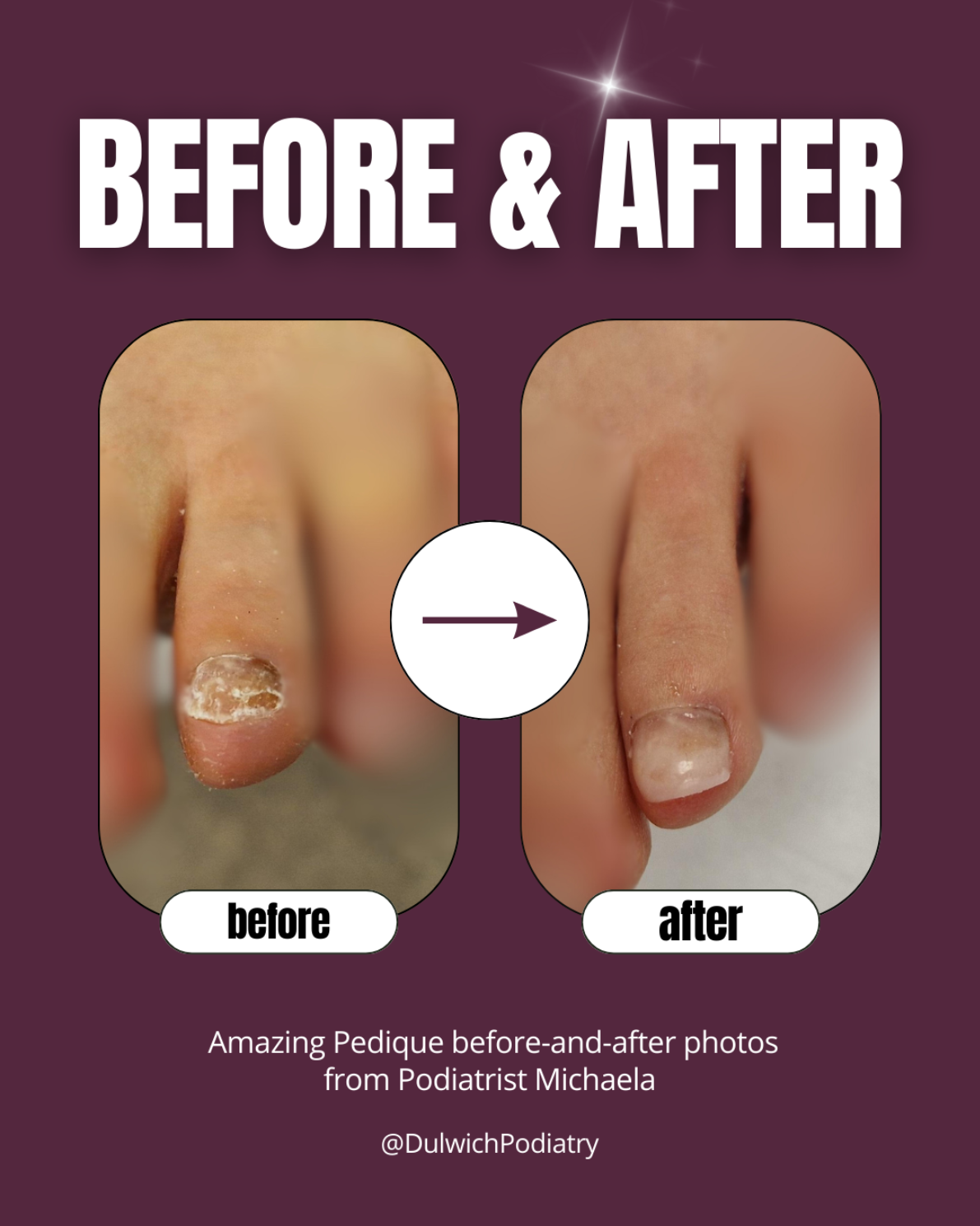 Wilde Pedique - Dulwich Podiatry